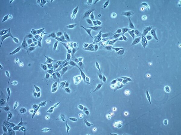 OECM-1 Human Oral Squamous Carcinoma Cell Line | SCC180